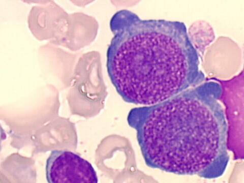 RBC Morphology And Identification - Quiz, Trivia & Questions