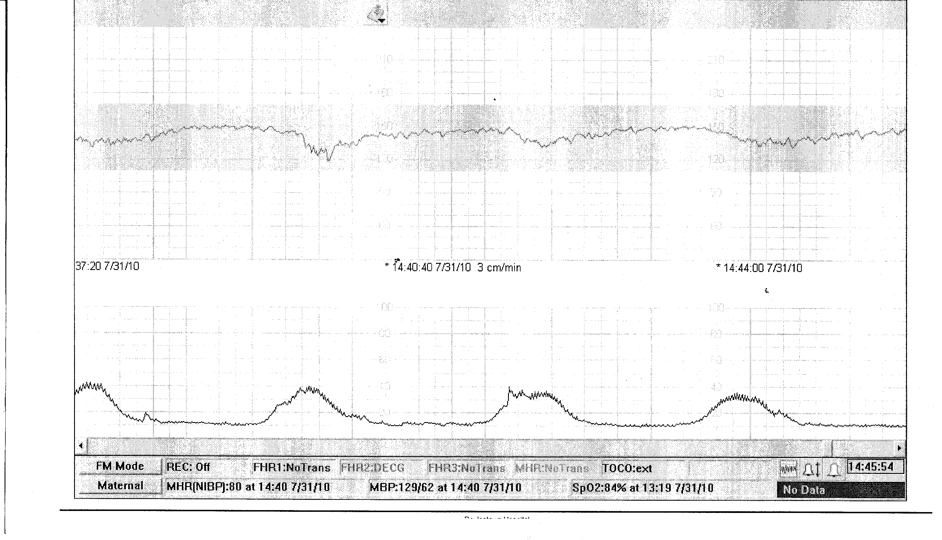 Intermediate Electronic Fetal Heart Monitoring - ProProfs Quiz