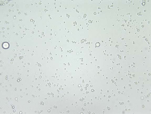 Hematology & Urinalysis Trivia Quiz - Quiz & Trivia