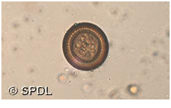 Cestodes (Tapeworms) - Quiz, Flashcards & Trivia