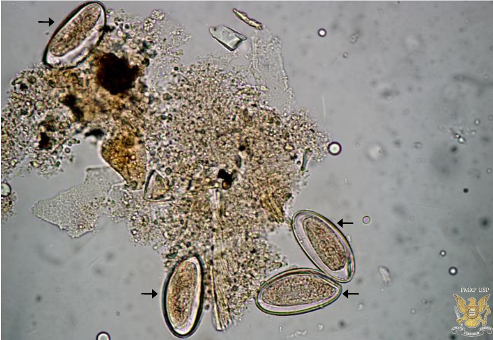 Helmintos; Asquelmintos; Gordius; Nematomorpha; Gusanos Parasitarios