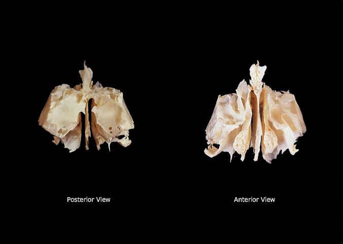 Skeletal Exam Study Guide - Quiz & Trivia