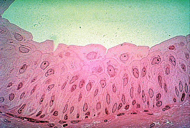 transitional epithelium - meddic